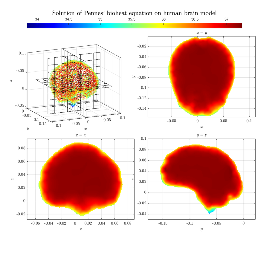 Bioheat equation - Medusa: Coordinate Free Mehless Method implementation